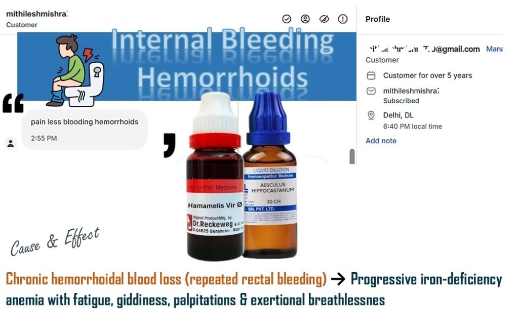 Internal Bleeding Hemorrhoids: Symptoms, Red Flags & Homeopathy